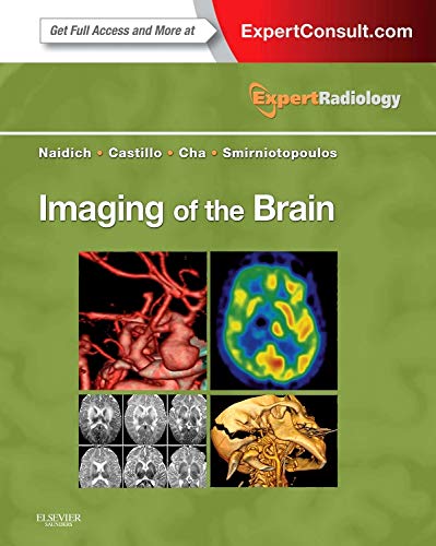 Imaging of the Brain: Expert Radiology Series : Castillo MD, Mauricio ...