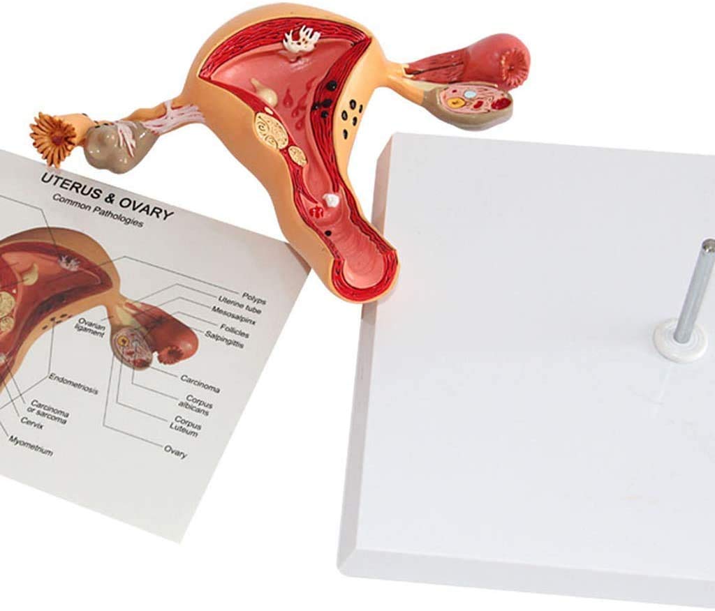 Buy Model of Uterine Injury Model of Female Anatomical Organs Internal ...
