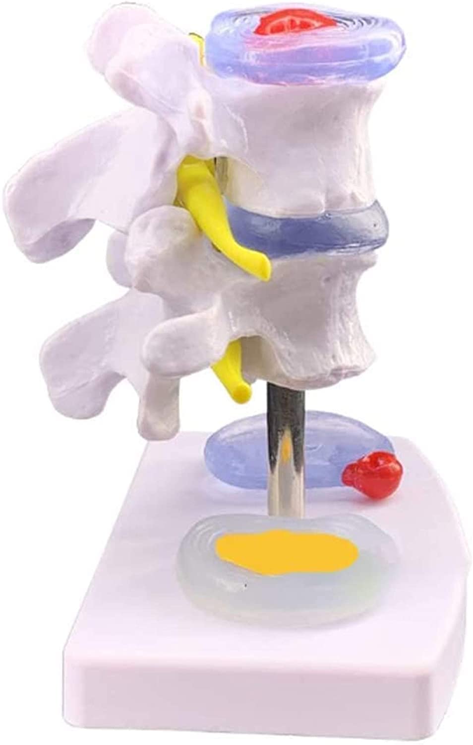 Buy Anatomy Model, Educational Model Human Anatomy Lumbar Spine Disc ...