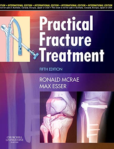 Buy Practical Fracture Treatment, International Edition Book Online at ...