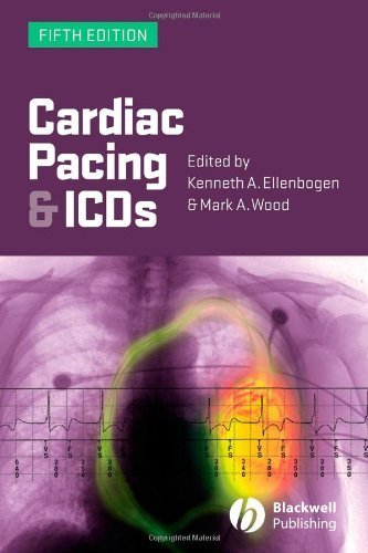 By Kenneth A. Ellenbogen MD, Mark A. Wood MD: Cardiac Pacing and ICDs ...