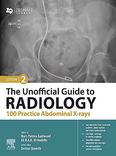 The Unofficial Guide to Radiology: 100 Practice Abdominal X-rays ...