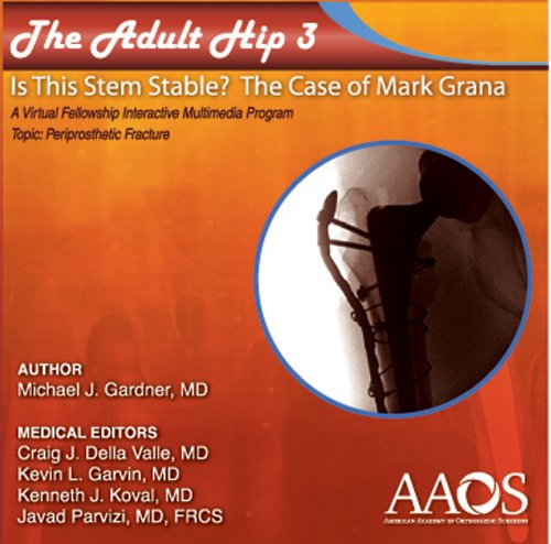 The Adult Hip: Case 3 (Periprosthetic Fractures): Is This Stem Stable ...