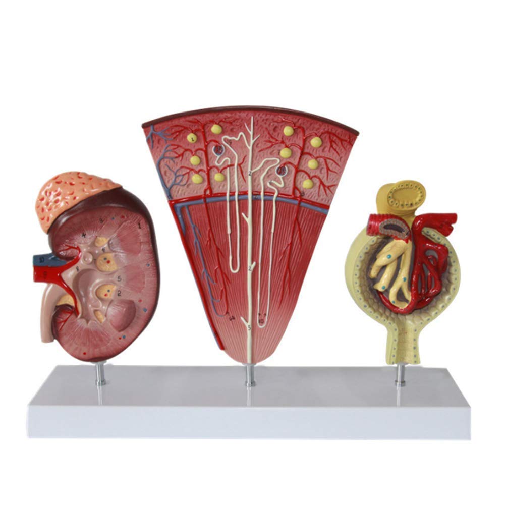 Buy BEAGHTY Kidney Anatomical Model Kidney Cross Section Glomerulus ...