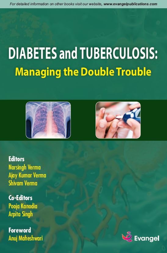 Buy Diabetes and Tuberculosis: Managing the Double Trouble Book Online ...