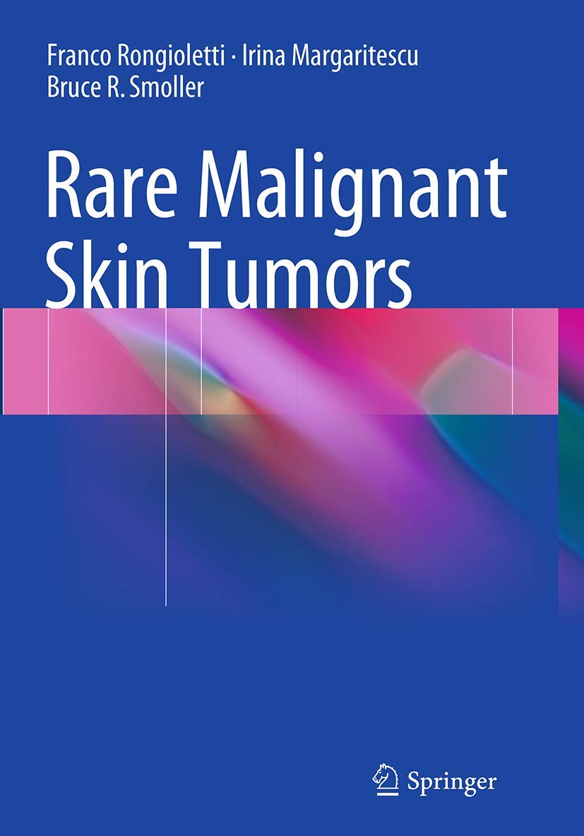 Rare Malignant Skin Tumors: 9781493948260: Medicine & Health Science ...