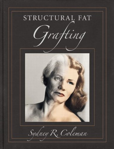 Structural Fat Grafting: 9781576261330: Medicine & Health Science Books ...