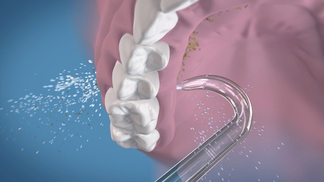 Snapklik.com : Waterpik Genuine Implant Denture Replacement Tips, Water ...