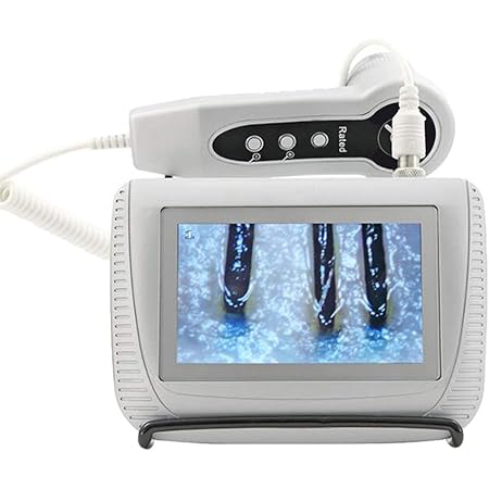 Amazon.com : Skin Diagnosis Hair Analyzer,10.1 Inch Charging Type Scalp ...