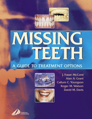 Missing Teeth: A Guide to Treatment Options: 9780443071539: Medicine ...