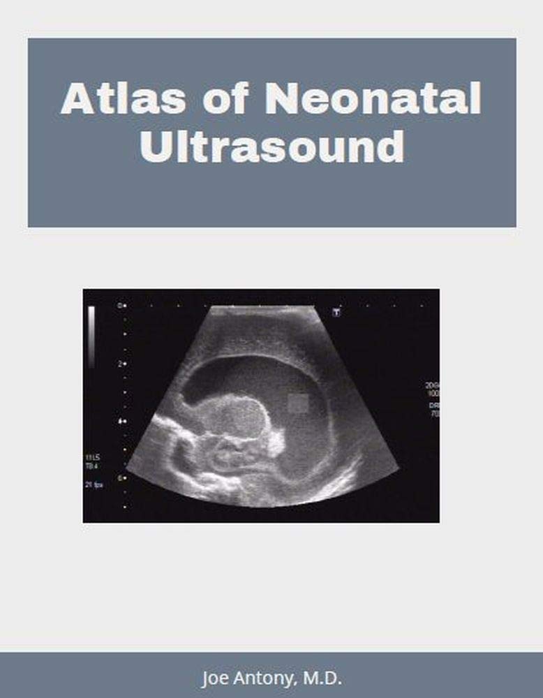 Amazon.com: Atlas of neonatal ultrasound: Sonographic atlas of neonatal ...