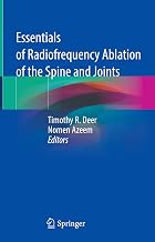Understanding The Radiofrequency Ablation Si Joint Cpt Code And Its ...