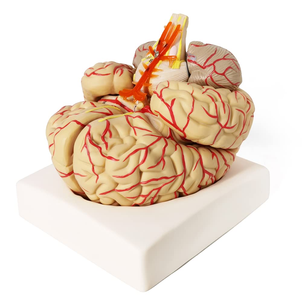 Snapklik.com : Evotech Human Brain Model w/Arteries, 9 Parts Life Size ...
