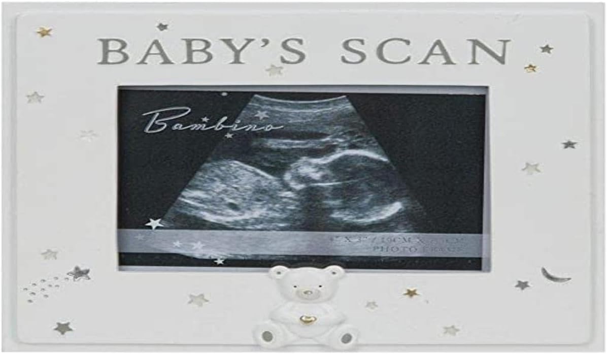 Baby's 1st Scan Photo Frame : Amazon.co.uk: Home & Kitchen