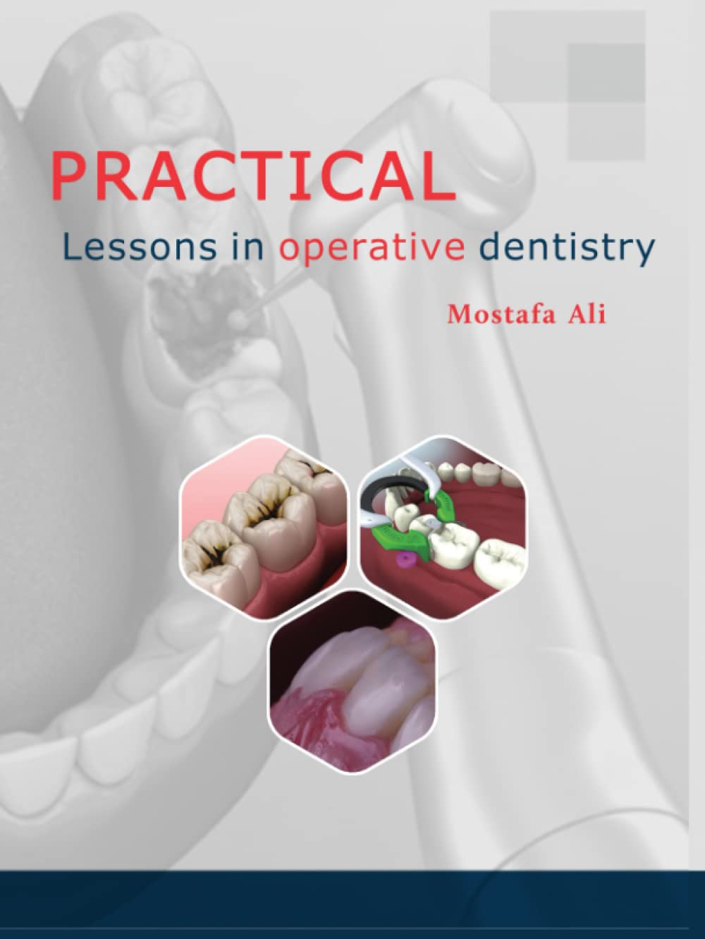 Practical lessons in operative dentistry: operative and restorative ...