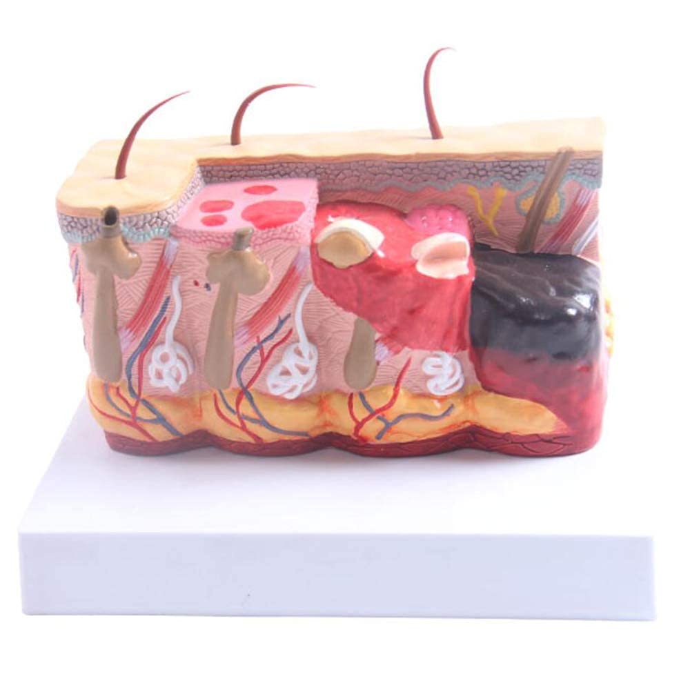 Buy Skin Anatomical ModelMedical Anatomical Skin Model Human Burn Skin ...
