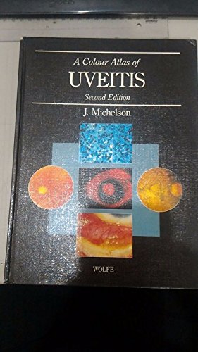 A Colour Atlas of Uveitis: Michelson MD FACS, Joseph B.: 9780723417293 ...
