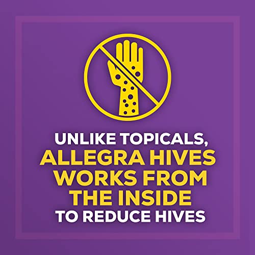 Allegra Hives Non-Drowsy Antihistamine Tablets, 30-Count, 24HR Hives ...