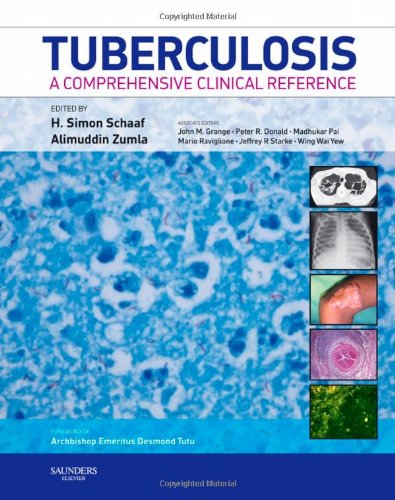 Buy Tuberculosis: A Comprehensive Clinical Reference Book Online at Low ...