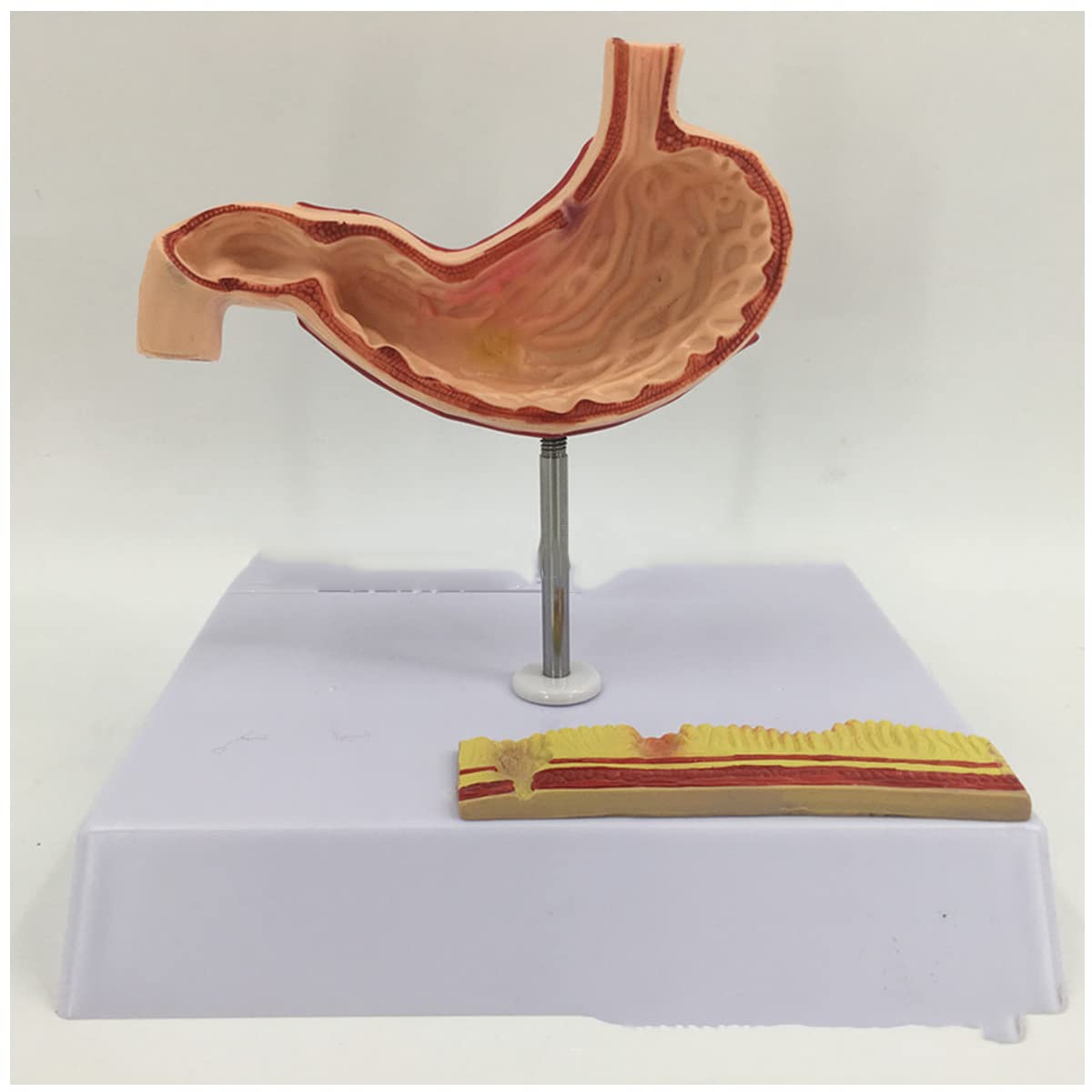 Buy Human Stomach Model Stomach Anatomy Pathological Model Medical ...