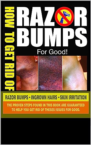 Amazon.com: HOW TO GET RID OF RAZOR BUMPS FOR GOOD: THE REAL TRUTH ...