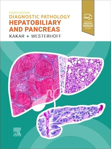 Diagnostic Pathology : Hepatobiliary and Pancreas: 9780443380228 ...