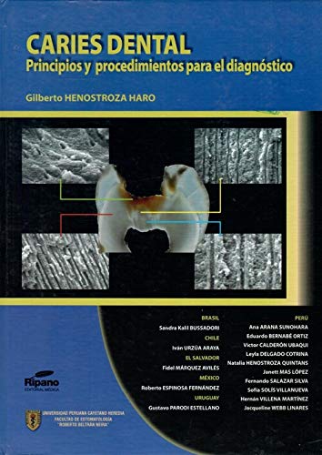 Caries dental. Principios y procedimientos para el diagnostico ...