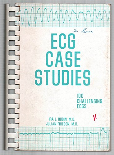 ECG Case Studies : 100 Challenging Electrocardiograms: Amazon.co.uk: Books
