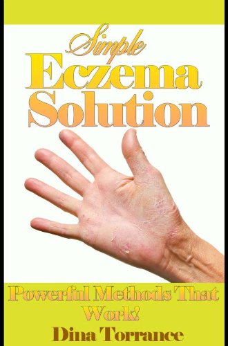Simple Eczema Solution (Eczema Treatment Guide Book 1) eBook : Torrance ...