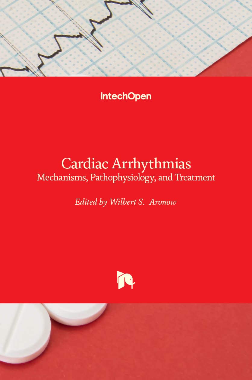 Buy Cardiac Arrhythmias: Mechanisms, Pathophysiology, and Treatment ...