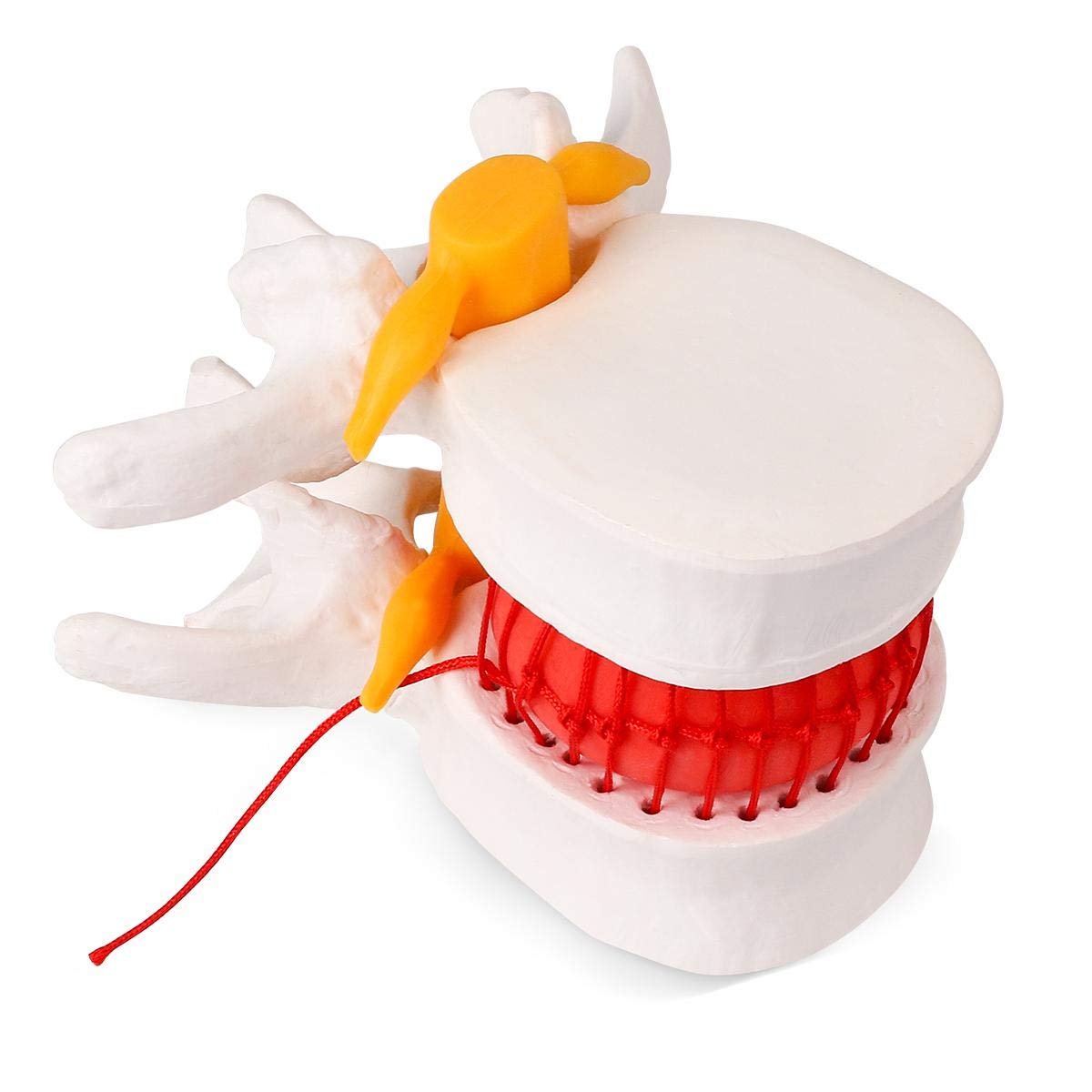 Snapklik.com : MIIRR Human Lumbar Disc Herniation Model, Vertebral ...