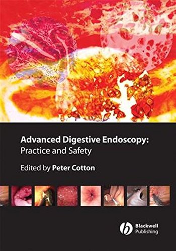Advanced Digestive Endoscopy: Practice and Safety: 9781444300277 ...