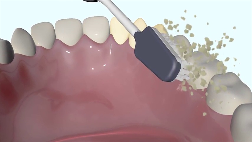 Watch Pursonic Rechargeable Sonic Toothbrush on Amazon Live