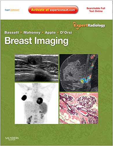 Breast Imaging: Expert Radiology Series: 9781416051992: Medicine ...