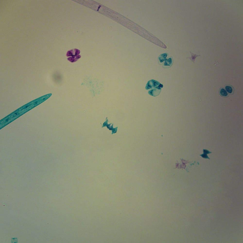 Desmids Under Microscope