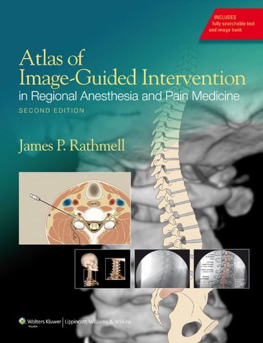 Atlas of Image-Guided Intervention in Regional Anesthesia and Pain ...