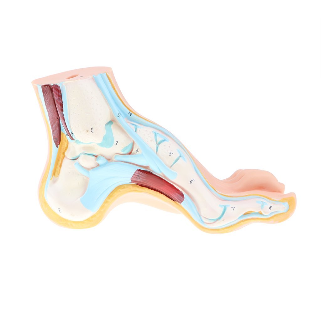 Buy Hollow Foot Pes Cavus Model - Arched Foot Skeleton Model With ...