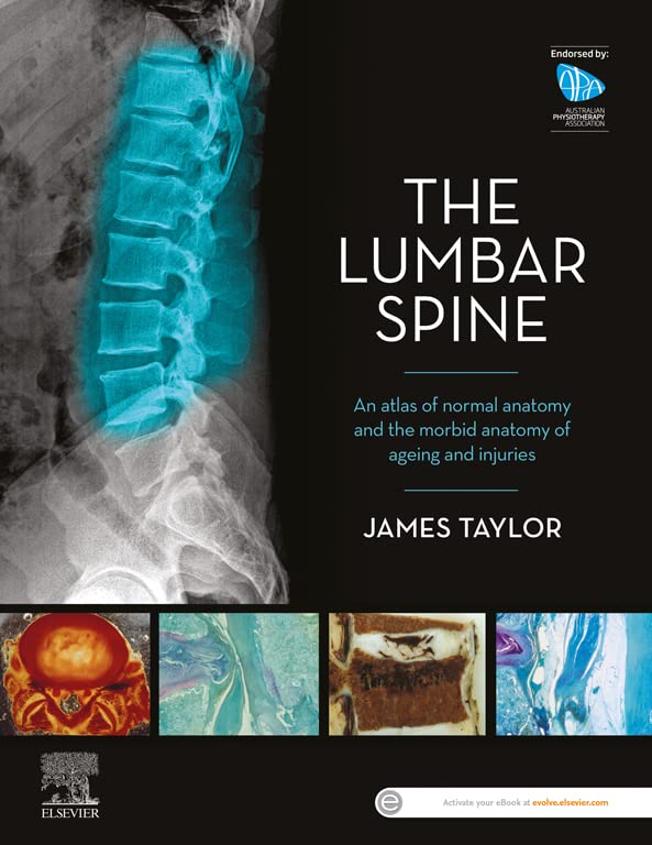 Amazon | The Lumbar Spine: An Atlas of Normal Anatomy and the Morbid ...