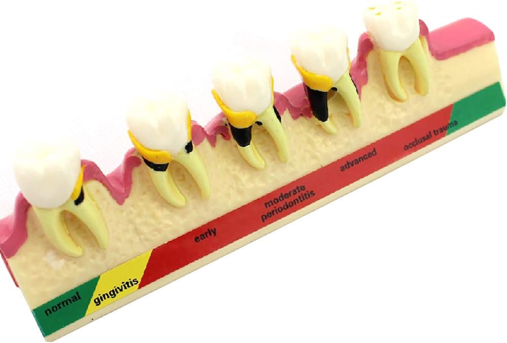 Amazon.com: Teaching Model,Dental Model, Large Dental Teeth Model, Oral ...