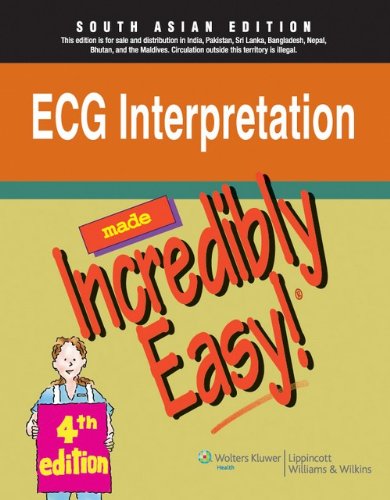 Made Incredibly Easy: Ecg Interpretation, 4/E: Springhouse ...