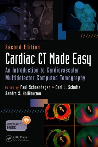 Cardiac CT Made Easy: An Introduction to Cardiovascular Multidetector ...