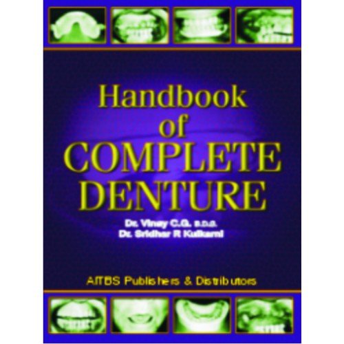 Handbook of Complete Dentures: VINAY: 9788174732521: Amazon.com: Books