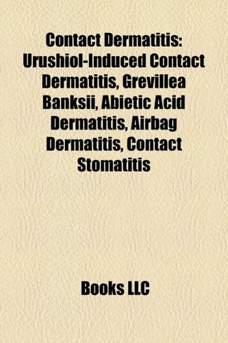 Contact Dermatitis: Urushiol-Induced Contact Dermatitis, Grevillea ...