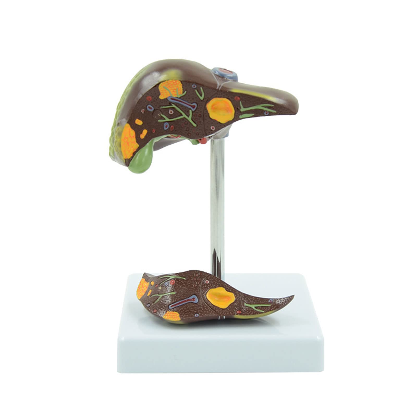 Buy JRZTC Liver Model Liver Pathology Model 2 Parts Human Liver ...