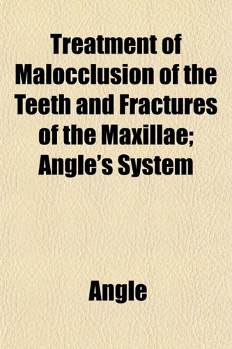Treatment of Malocclusion of the Teeth and Fractures of the Maxillae; Angle's System | Amazon.com.br