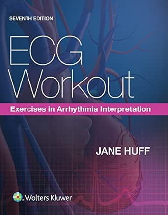 ECG Workout: Exercises in Arrhythmia Interpretation: Huff, Jane ...