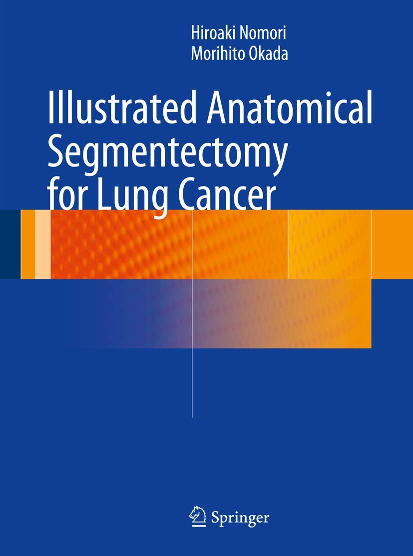 Amazon Illustrated Anatomical Segmentectomy For Lung Cancer Nomori Hiroaki Okada Morihito
