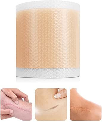 Amazon.co.jp: Keloid Tape Silicone Gel Sheet for Scratches and Care ...
