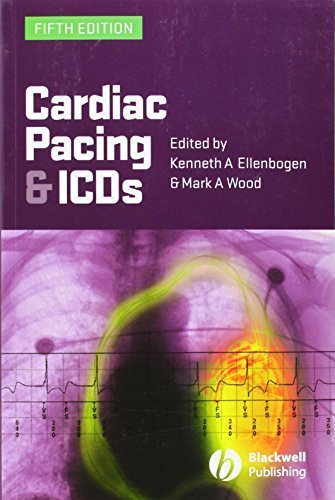 Cardiac Pacing and ICDs by Kenneth A. Ellenbogen (2008-06-23): Kenneth ...