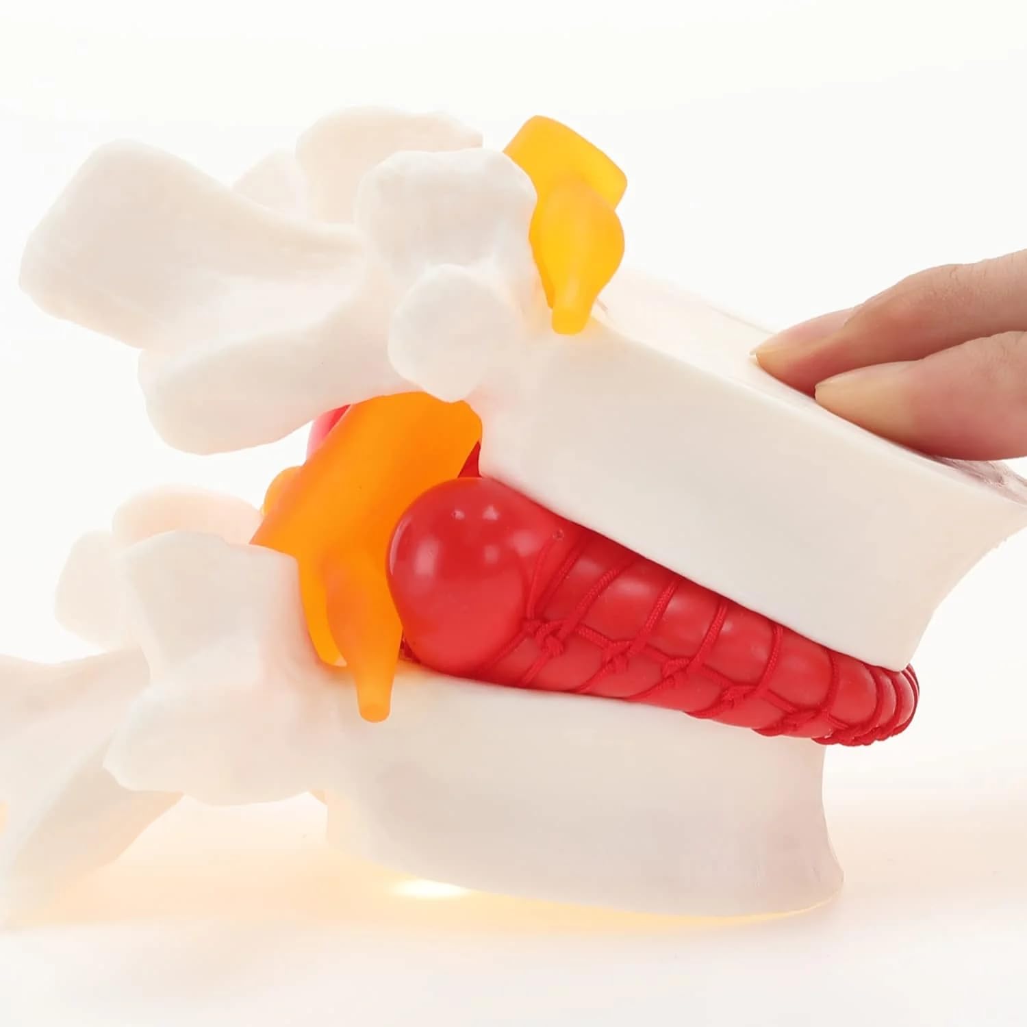 Snapklik.com : Human Anatomical Lumbar Disc Herniation Model - Lumbar ...